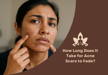 How Long Do Acne Scars Take to Fade? Real Healing Timeline – Pokonut